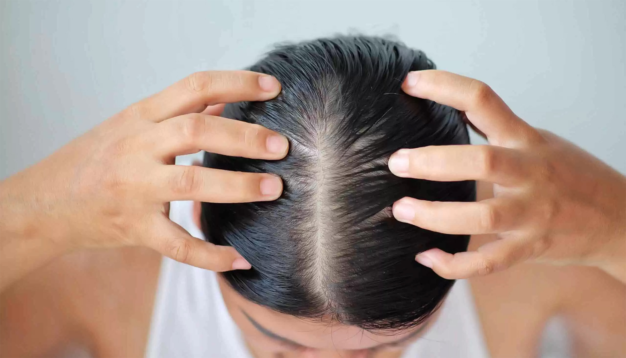 Are Itchy Scalp and Hair Loss Connected? | Hair Doctors